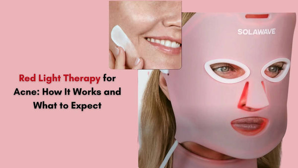 Red Light Therapy for Acne: How It Works & What to Expect - Solawave