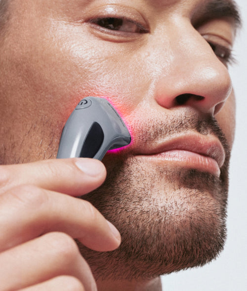 Blue Light Therapy Device For Acne | Bye Acne | Solawave